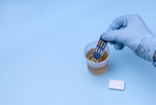 Opioid Drug Testing | Hair, Blood & Urine Tests | Opiates in the Body